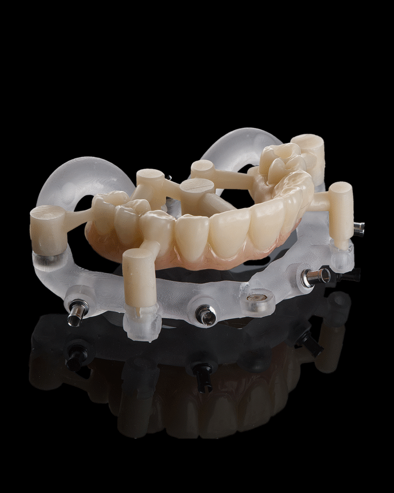 Guides Chirurgicaux – Digilab Solutions